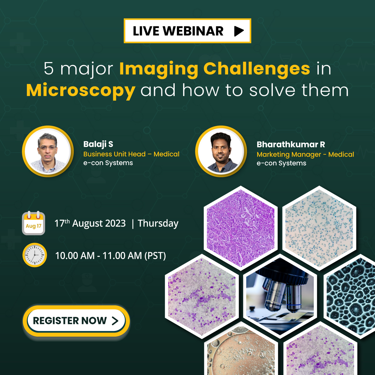 Upcoming Webinar Explores How to Solve Imaging Challenges in Microscopy ...